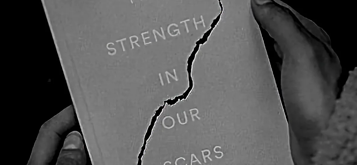 News | Creative writing prize | Scars Short Story Competition | Writers ...